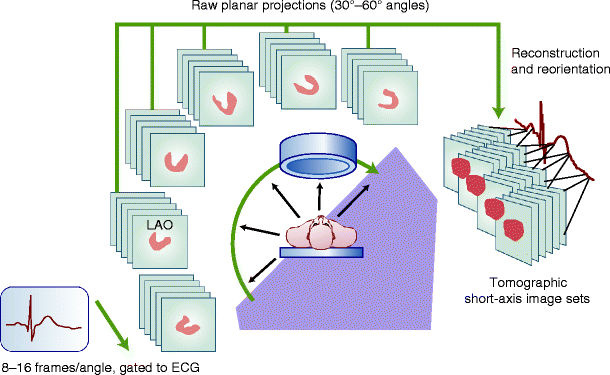 Assessment of Cardiac Function: First-Pass, Equilibrium Blood Pool, and ...