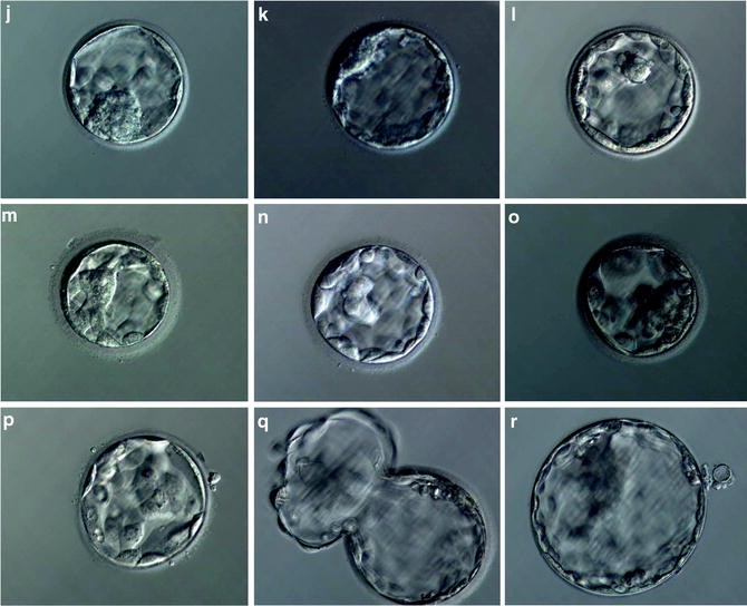 Morphological Assessment of Blastocyst Stage Embryos: Types of Grading ...