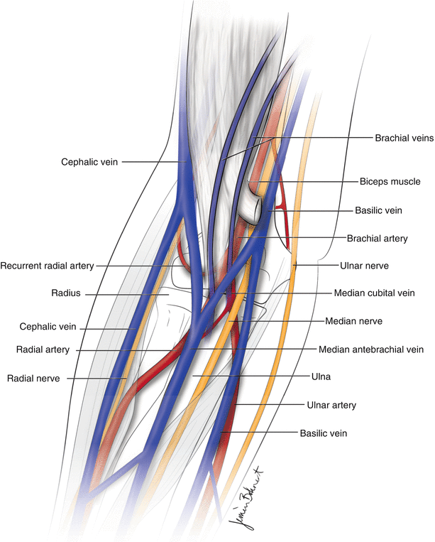 Radial and Brachial Access | SpringerLink