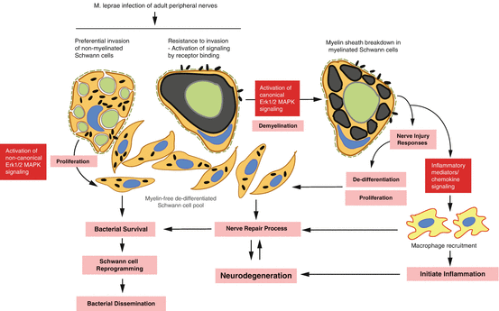 Leprosy Diagram