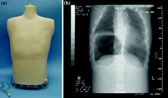 Imaging Phantoms: Conventional X-ray Imaging Applications | SpringerLink