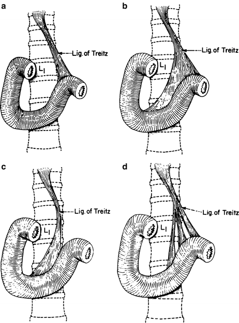 Duodenum | SpringerLink