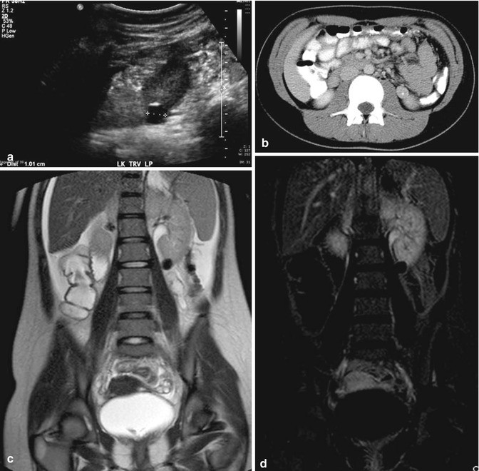 Renal Imaging: Cystic and Solid Lesions | SpringerLink
