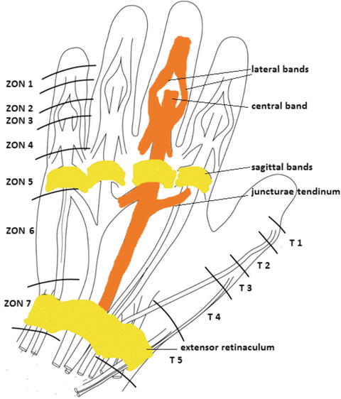 Functional Assessment in Hand with Flexor and Extensor Tendon Injuries ...