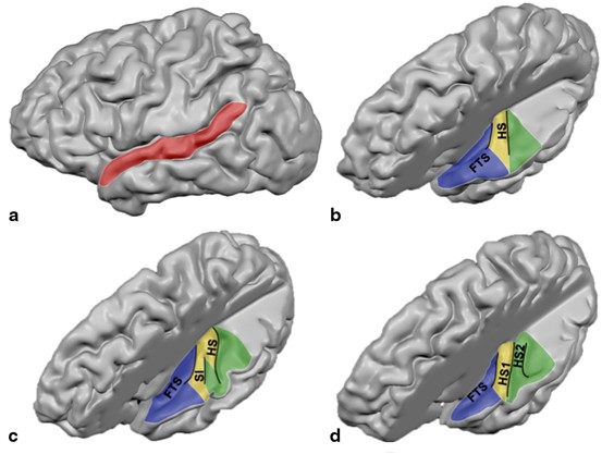 Functional MRI of the Auditory Cortex | SpringerLink