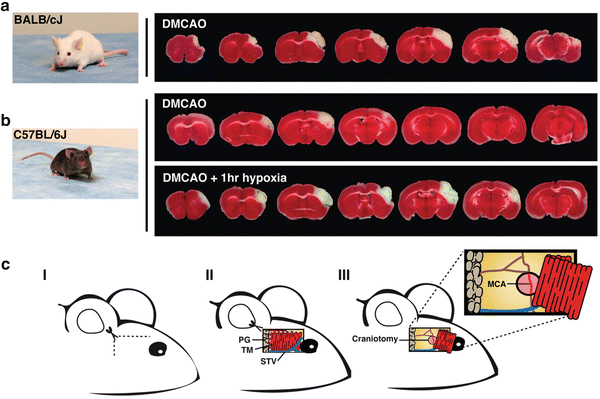 A Mouse Model of Permanent Focal Ischemia: Distal Middle Cerebral ...