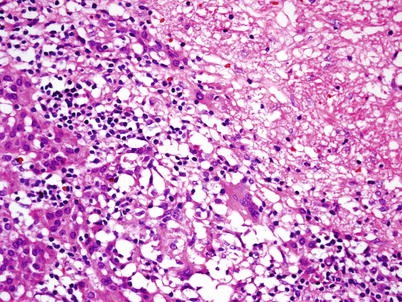 Adrenal Gland Histology | SpringerLink