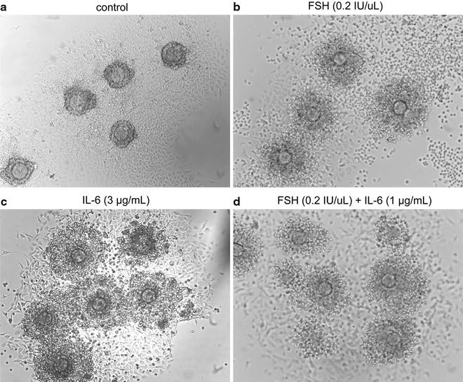 In Vitro Maturation and In Vitro Fertilization of Mouse Oocytes and ...