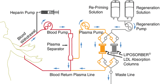 Apheresis Methods in Hyperlipidemias | SpringerLink
