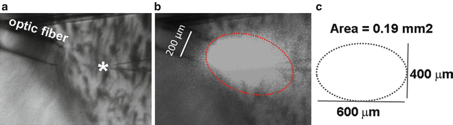 Acute Brain Slice Methods for Adult and Aging Animals: Application of ...
