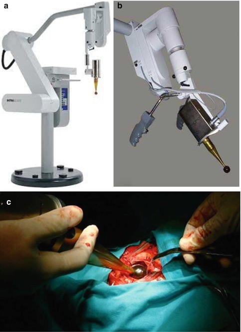 The Emerging Role of Intraoperative Radiation Therapy [IORT] in Breast ...