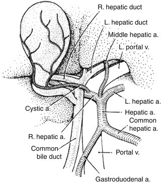 Vascular Injuries of Porta Hepatis | SpringerLink