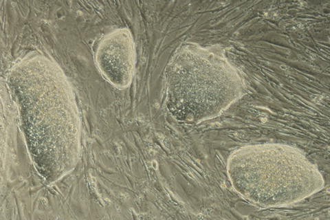 Isolation and Handling of Mouse Embryonic Fibroblasts | SpringerLink