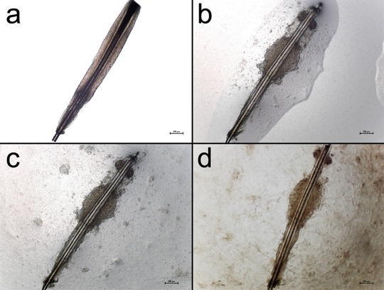 Differentiating the Stem Cell Pool of Human Hair Follicle Outer Root ...