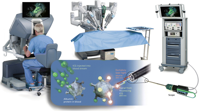 Fluorescence Image-Guided Robotic Surgery | SpringerLink