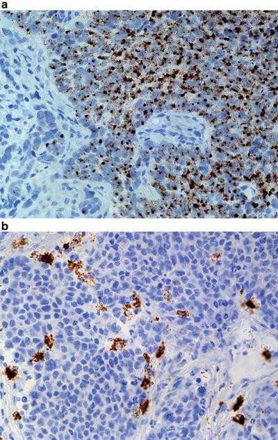Quantitative Ultrasensitive Bright-Field RNA In Situ Hybridization with ...