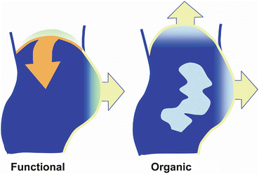 Gas and Bloating | SpringerLink