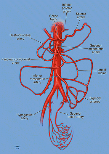 Technique of Open Mesenteric Catheter Embolectomy | SpringerLink