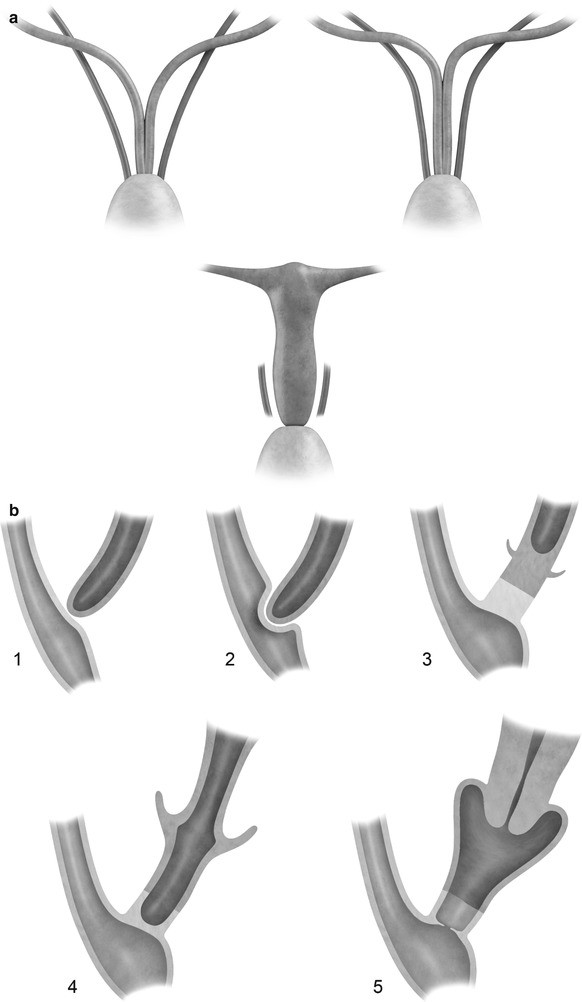 Cross-Sectional Imaging of the Uterus | SpringerLink