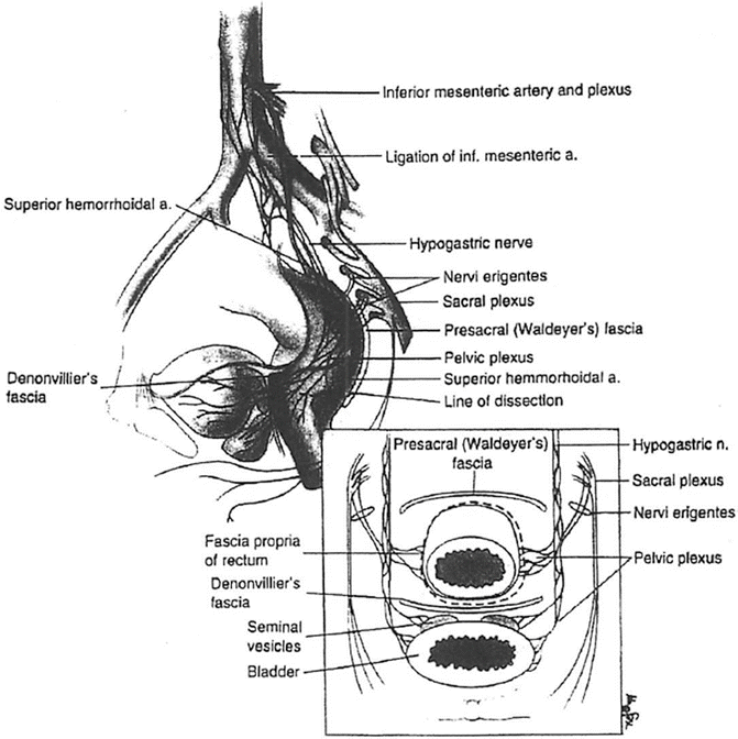 Open Technique for Low Anterior Resection | SpringerLink