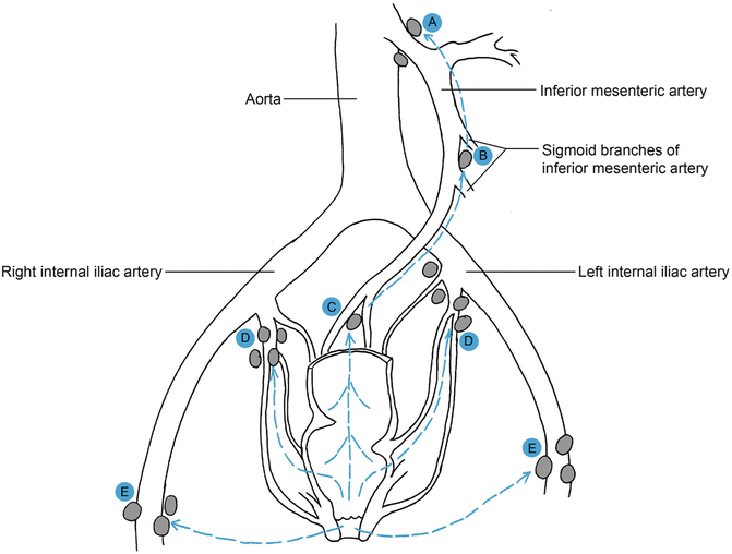 Open Technique for Low Anterior Resection | SpringerLink