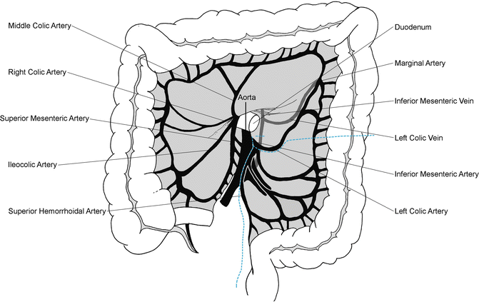 Open Technique for Low Anterior Resection | SpringerLink