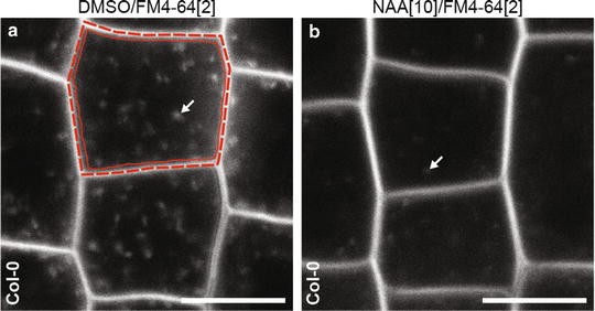 Live Cell Imaging of FM4-64, a Tool for Tracing the Endocytic Pathways ...