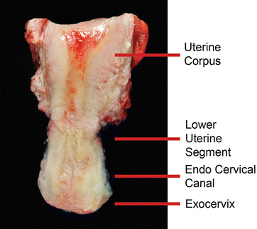 Normal Histology and Cytology of the Endocervix and Endometrium ...