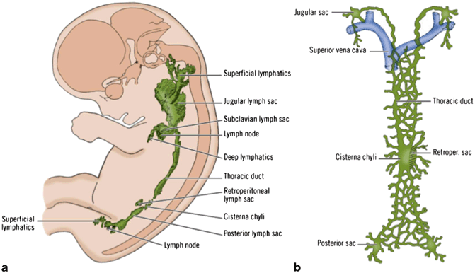 Chyle Leak After Esophageal Surgery | SpringerLink