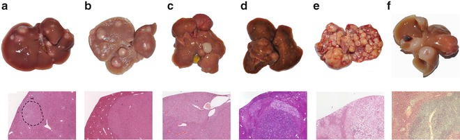 Mouse Models of Liver Cancer | SpringerLink