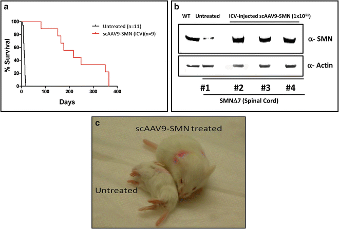 Gene Therapy in Spinal Muscular Atrophy (SMA) Models Using ...