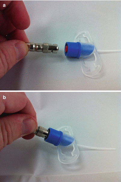 Percutaneous Transtracheal Jet Ventilation | SpringerLink