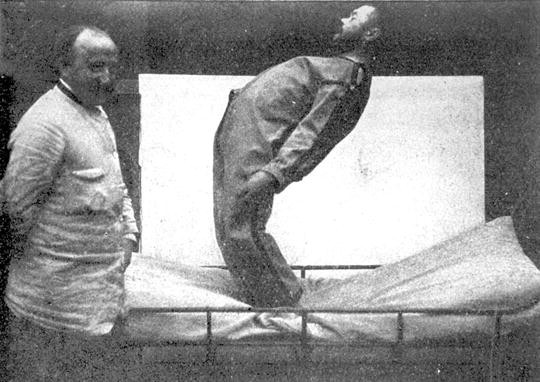 Catatonia in Psychiatric Illnesses | SpringerLink