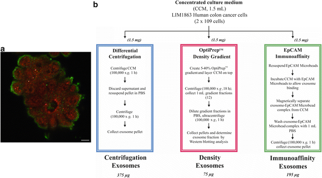 A Protocol for Exosome Isolation and Characterization: Evaluation of ...
