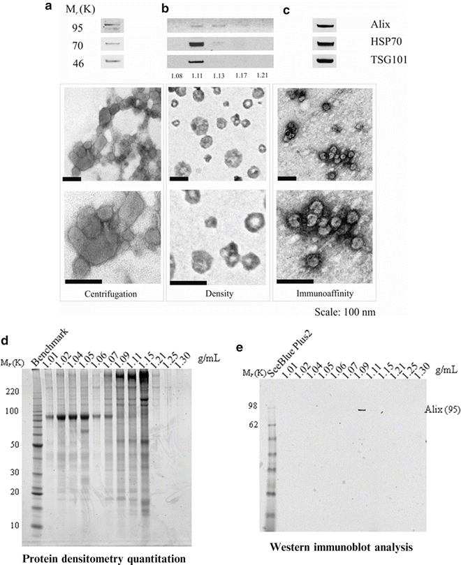 A Protocol for Exosome Isolation and Characterization: Evaluation of ...