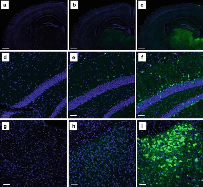Tyramide Signal Amplification for Immunofluorescent Enhancement | SpringerLink
