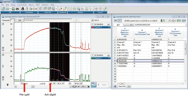 Wire Myography to Study Vascular Tone and Vascular Structure of ...