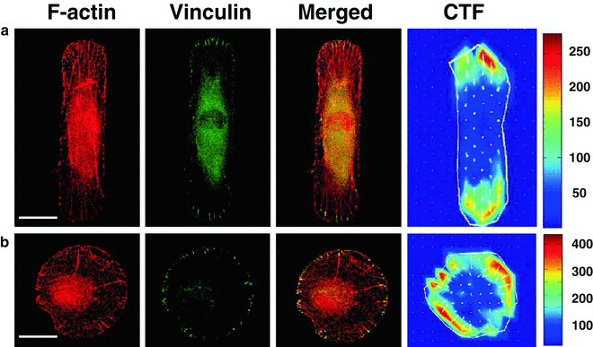 The Study of Cell Motility by Cell Traction Force Microscopy (CTFM ...