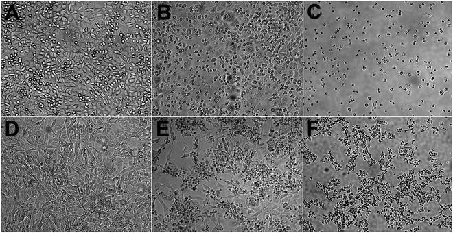 Isolation and Characterization of Poliovirus in Cell Culture Systems ...