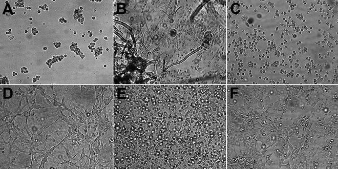 Isolation and Characterization of Poliovirus in Cell Culture Systems ...