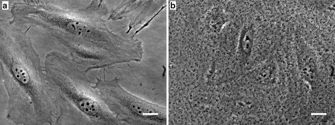 An Optimized Calcium-Phosphate Transfection Method for Characterizing ...