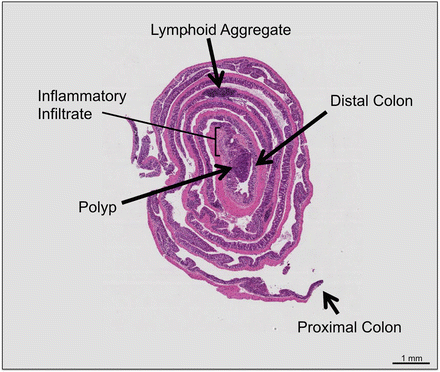 AOM/DSS Model of Colitis-Associated Cancer | SpringerLink