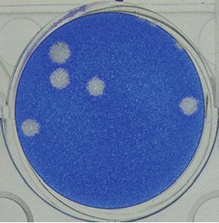 Neutralization Assay for Chikungunya Virus Infection: Plaque Reduction ...