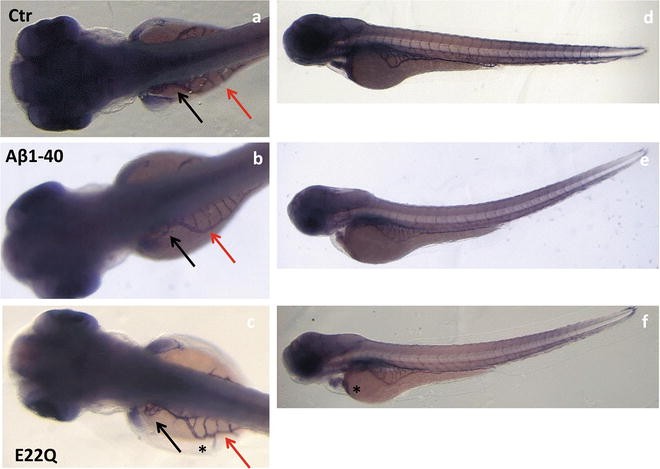 Studying Vascular Angiogenesis and Senescence in Zebrafish Embryos ...