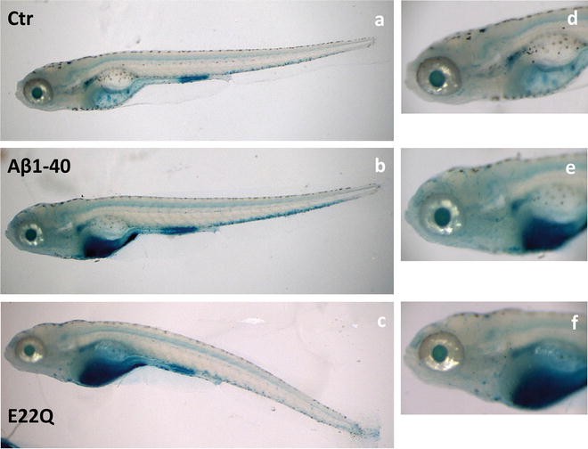 Studying Vascular Angiogenesis and Senescence in Zebrafish Embryos ...