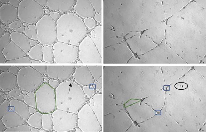 Tube-Forming Assays | SpringerLink