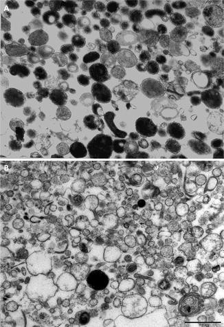 Isolation of Lysosomes from Mammalian Tissues and Cultured Cells ...