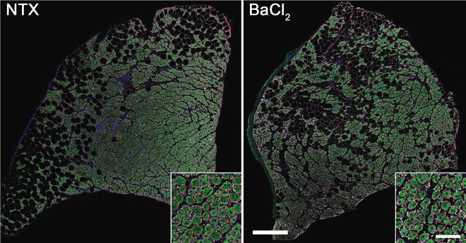 Inducing and Evaluating Skeletal Muscle Injury by Notexin and Barium ...