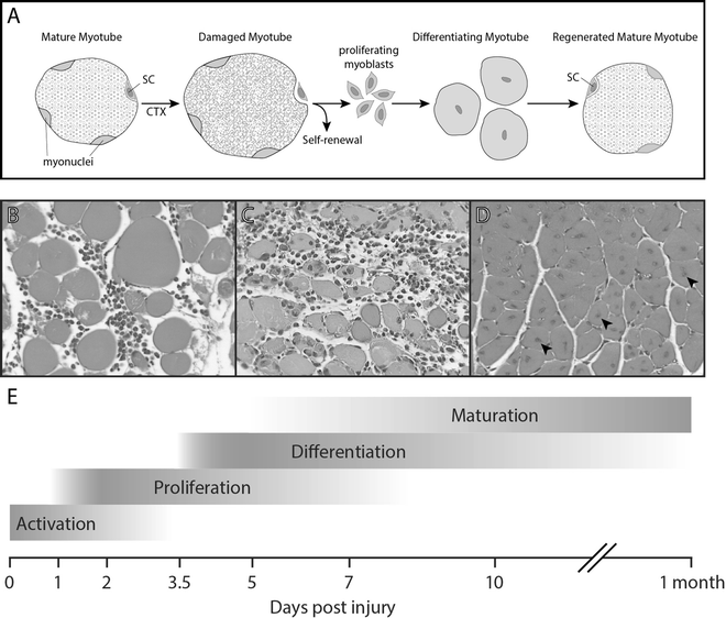 Cardiotoxin Induced Injury and Skeletal Muscle Regeneration | SpringerLink