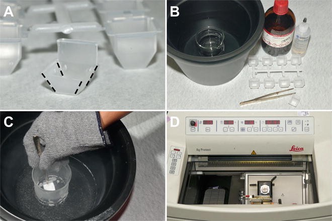 Cardiotoxin Induced Injury and Skeletal Muscle Regeneration | SpringerLink